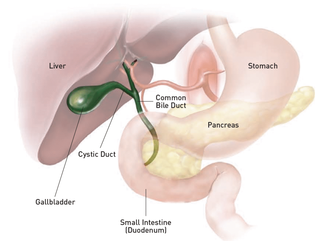 Gallbladder Surgery in Malaysia | Safe Laparoscopic Cholecystectomy